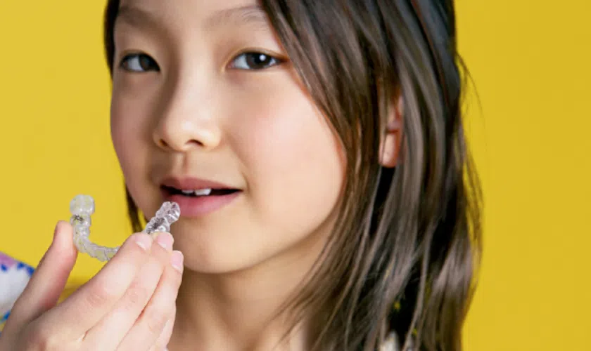 5 Truths About Invisalign Treatment for Kids